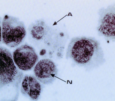 Jak umiera komórka? Czyli o nekrozie i apoptozie. - EDU TRUST